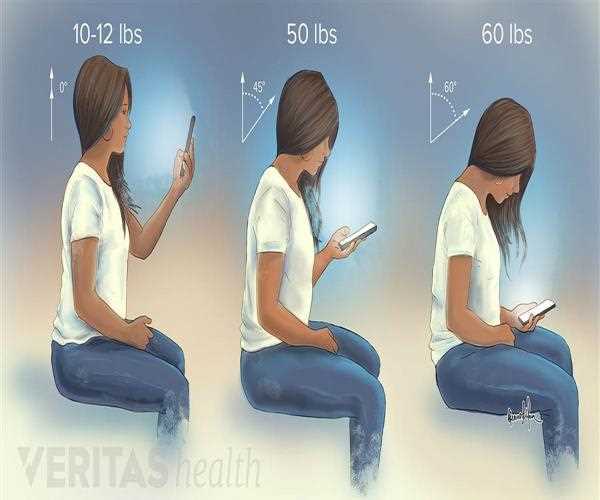 What Is Tech Neck? – MindStick